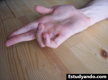 Dorsiflexión: Definición y Contractura | Estudyando