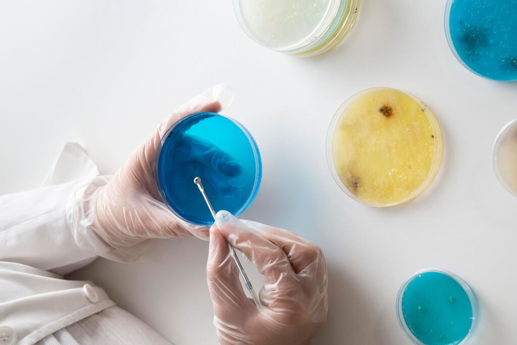 Tipos de coloraciones más usadas en Microbiología | Estudyando